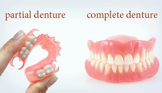 Best Partial Dentures: Types